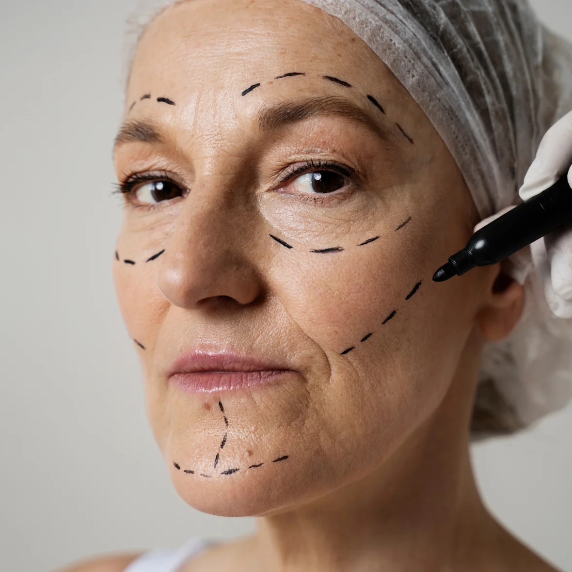 Capizzi MD – Charlotte Plastic Surgery & Skincare Center