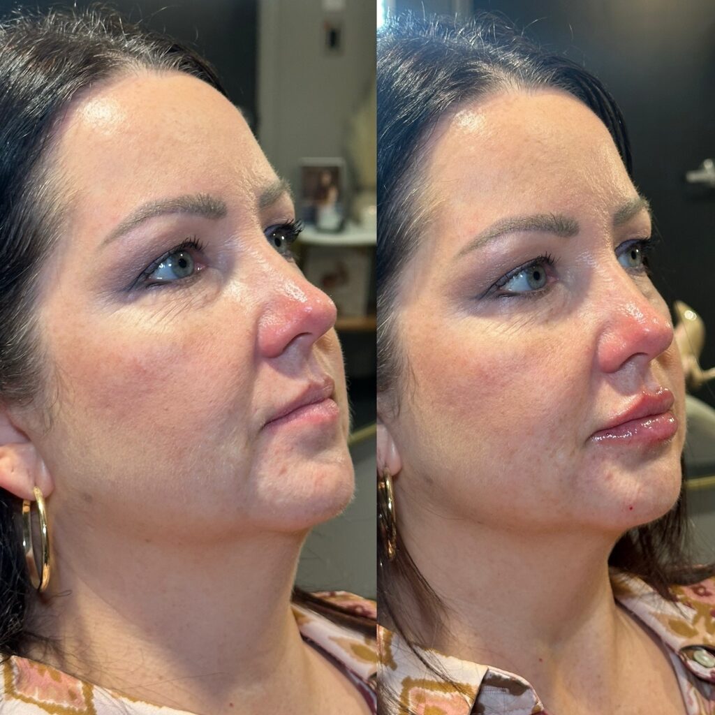 Capizzi MD – Charlotte Plastic Surgery & Skincare Center