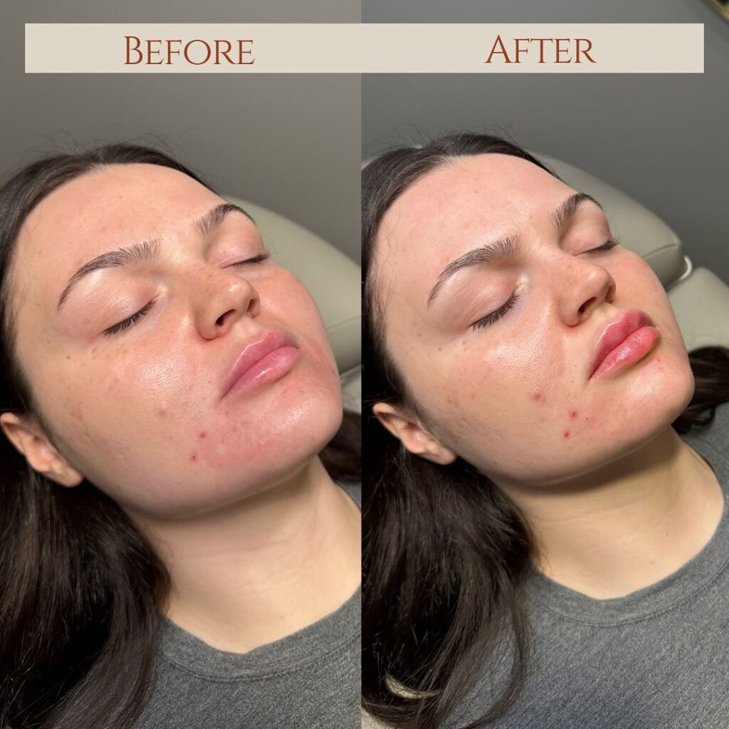 Capizzi MD – Charlotte Plastic Surgery & Skincare Center